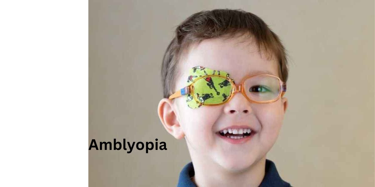 Amblyopia - HEALTH